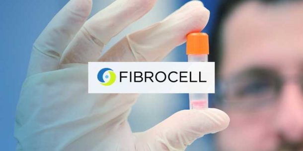 Fibrocell to Present at Phacilitate Leaders World 2019 - World Stem ...